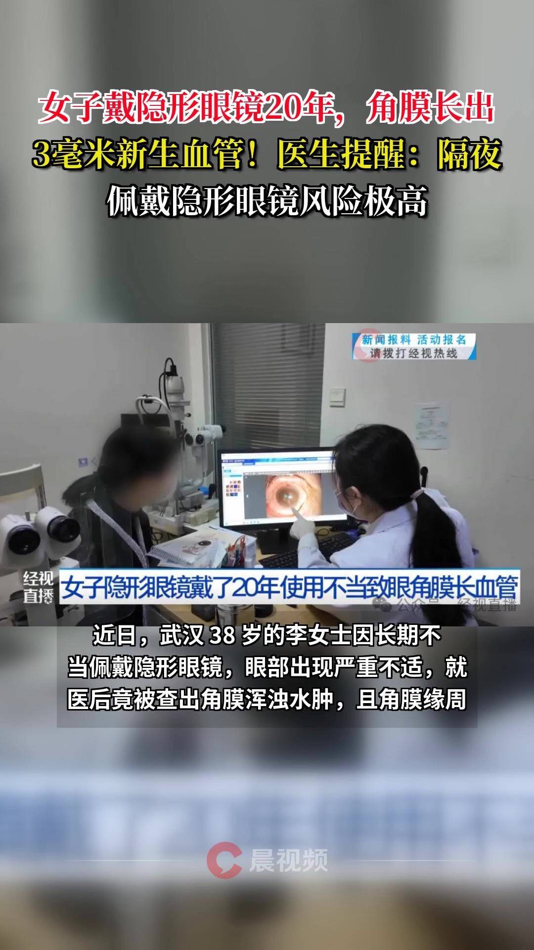女子戴隐形眼镜20年,角膜长出3毫米新生血管!医生提醒:隔夜佩戴隐形...