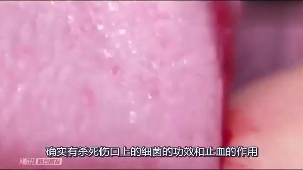 手指割破出血,用嘴嘬一嘬能止血?真的科学吗?