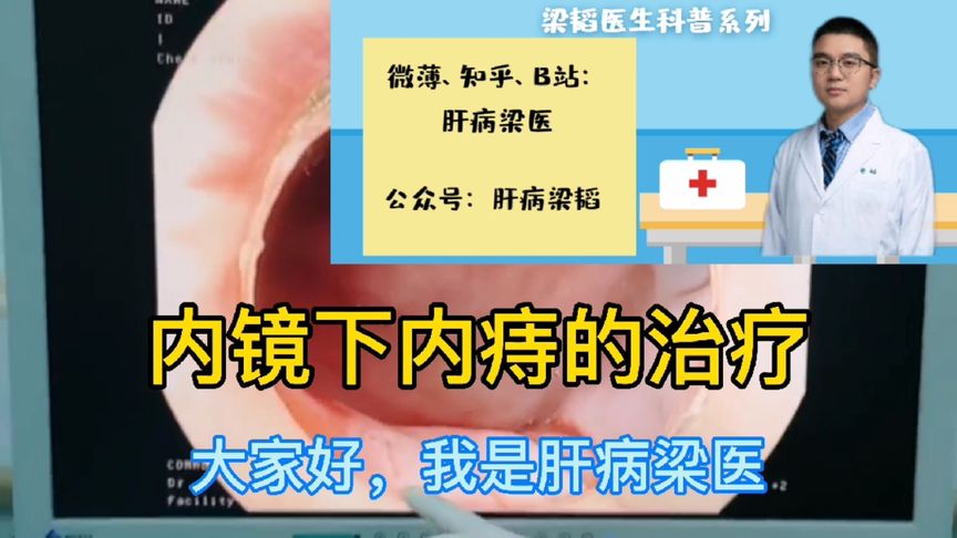 内镜下内痔的治疗