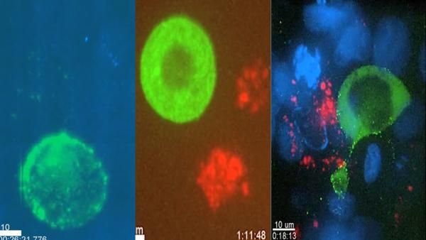 研究人员首次视频呈现HIV感染过程