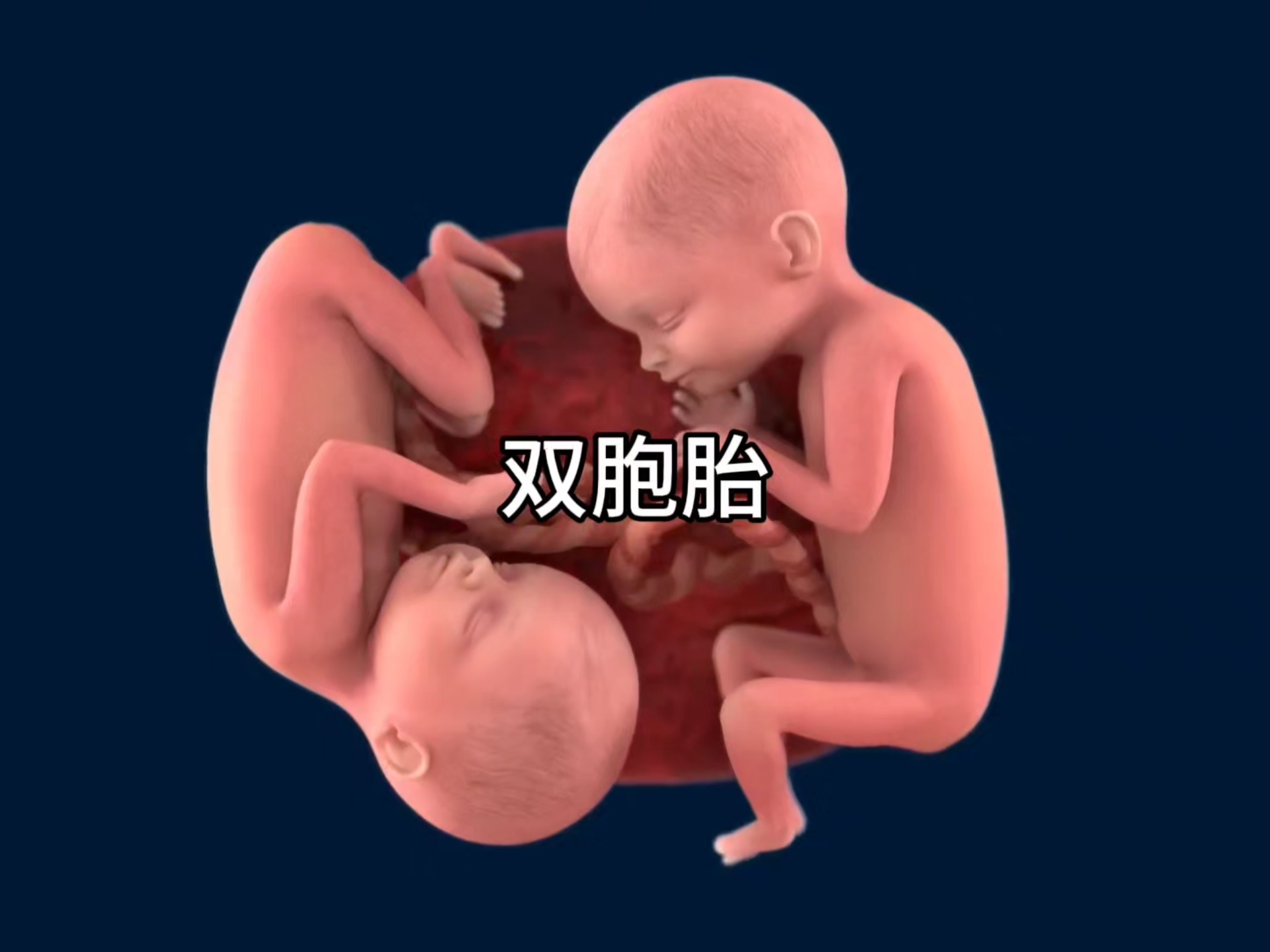3d动画演示双胞胎是如何形成的
