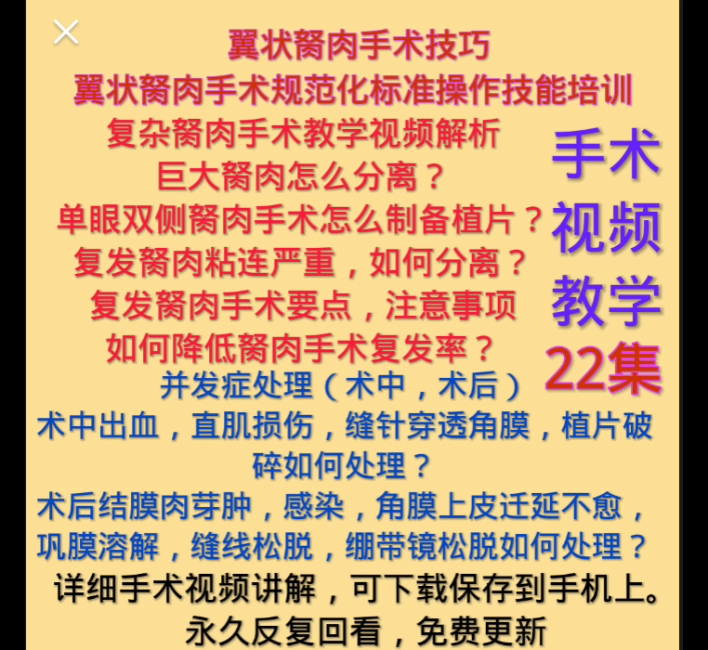 翼状胬肉切除手术教学视频角膜缘干细胞羊膜移植结膜瓣覆盖遮盖手术...