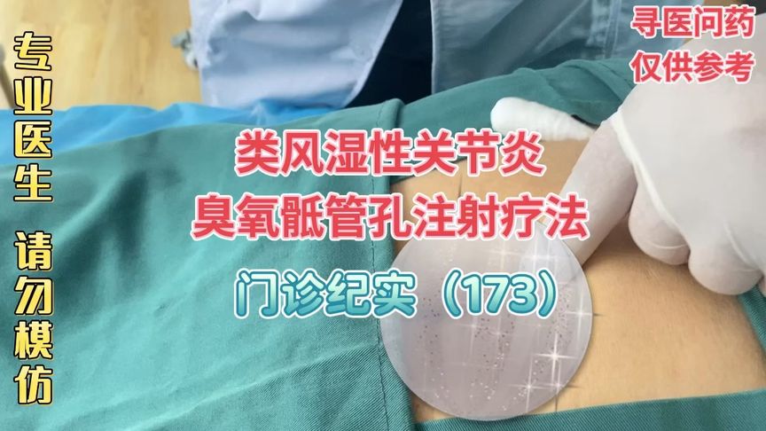 乡医杨涛:风湿类风湿性关节炎臭氧骶管孔注射疗法。