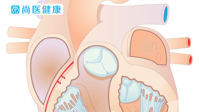 主动脉瓣关闭不全吃什么药?专家力荐它,效果棒棒哒!