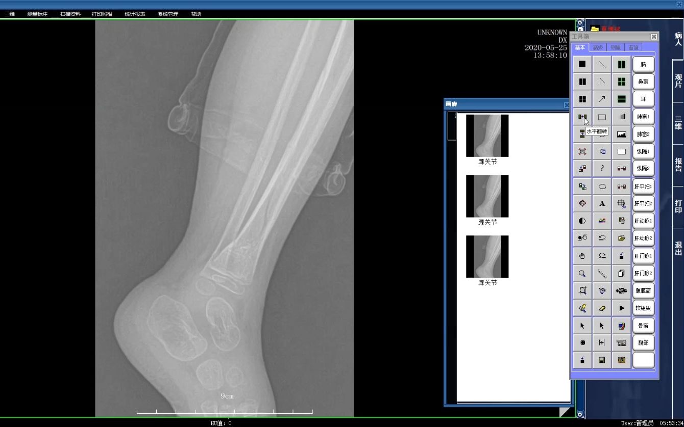 医院PACS支持高级影像重建后处理
