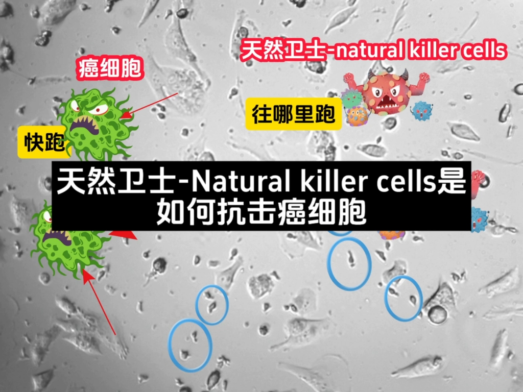 来看看NK细胞是如何杀死肿瘤细胞