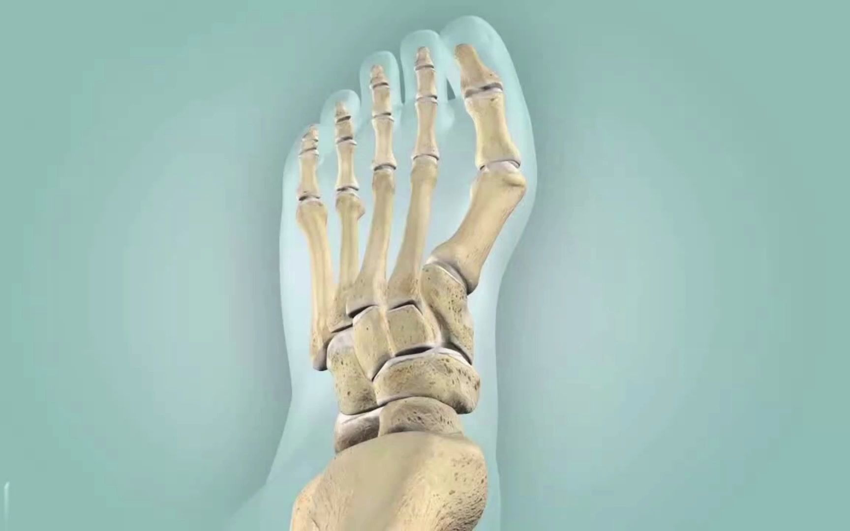 医学视频:拇指外翻切除手术