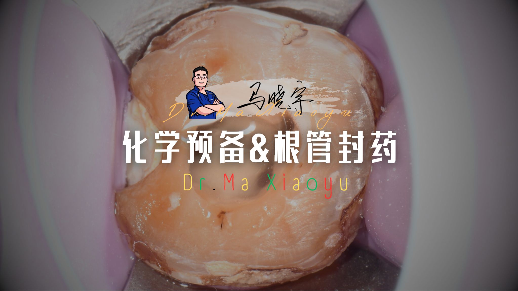 根管治疗关键细节还是细节