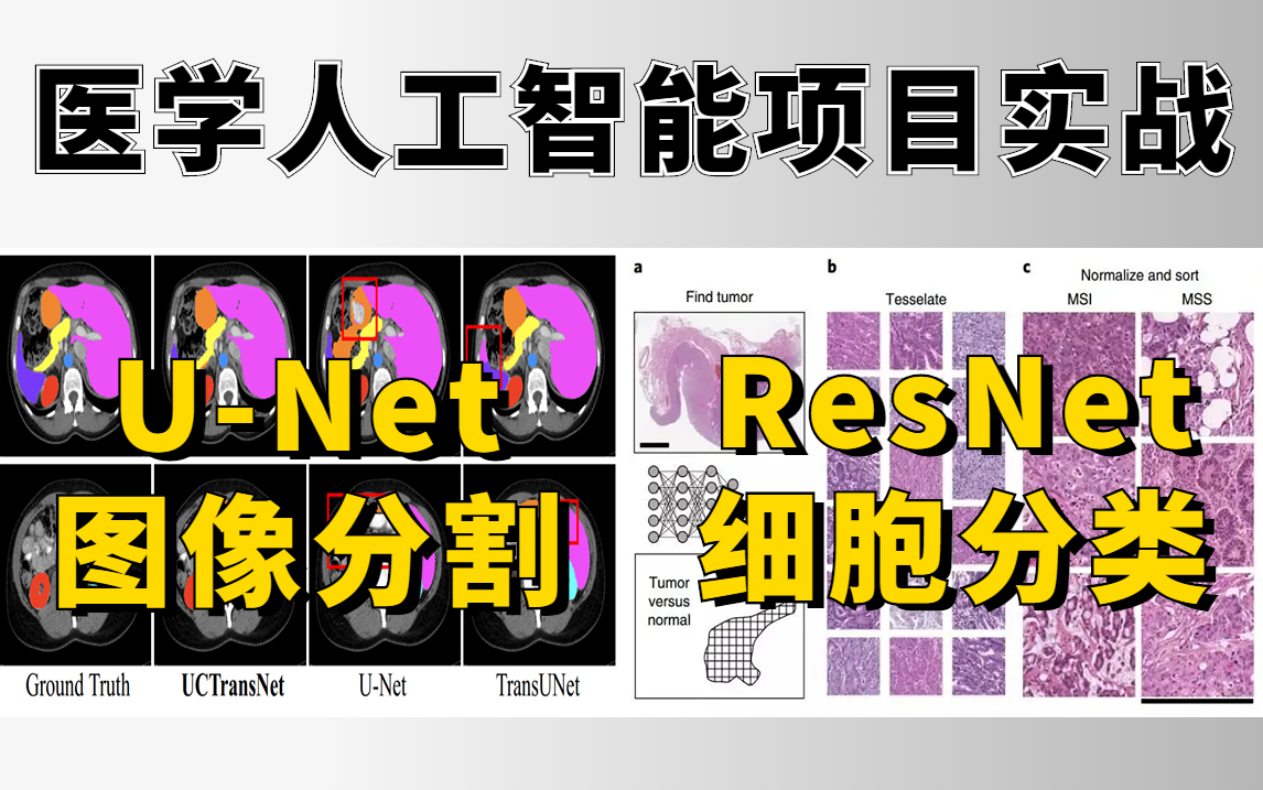 强推!医学人工智能项目实战教程:基于U-Net的医学图像分割实战+基于...
