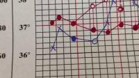 体温单的绘制5