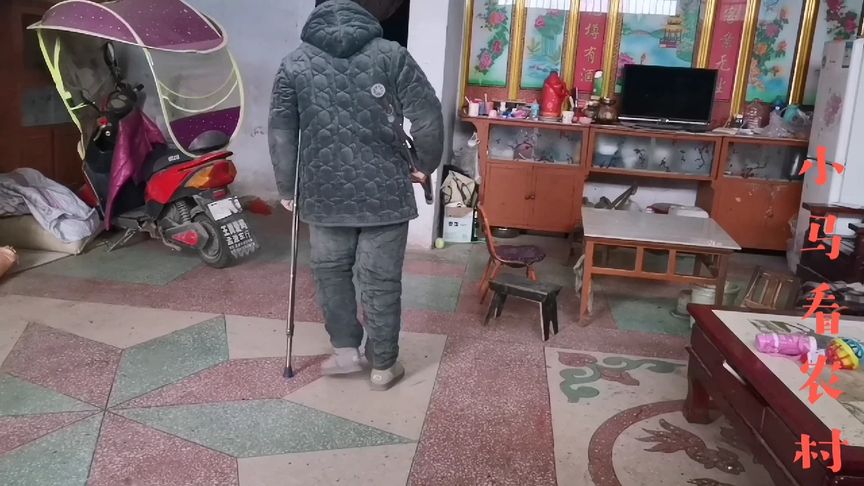 骨折小伙五个月了 单拐走路有劲了 蹲下也行了 加油