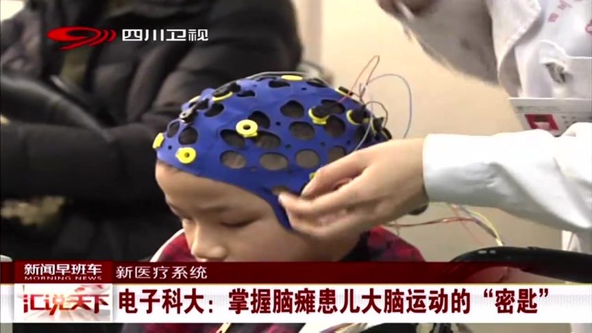 电子科大:掌握脑瘫患儿大脑运动的“密匙”