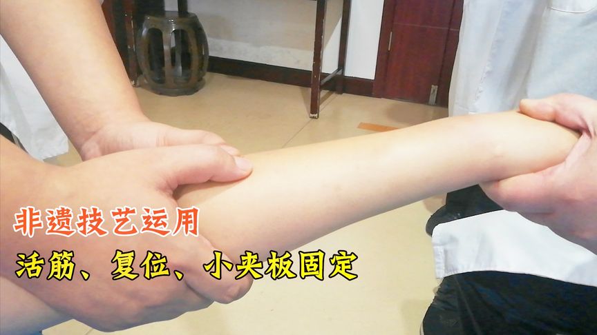 非遗正骨:骨折中医疗法,活筋、复位、小夹板固定