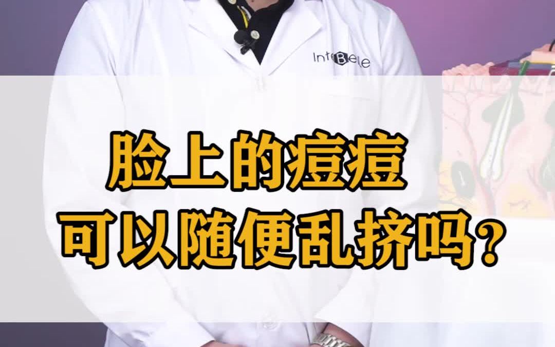 脸上的痘痘可以随便乱挤吗?