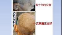 黄氏真菌王使用效果图(美篇)