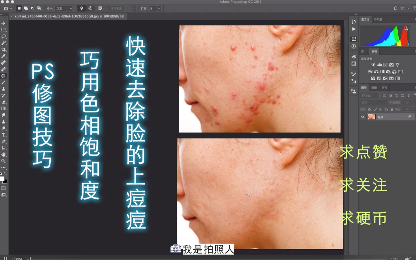 ps修图技巧 修补替换结合色相饱和度 完美去除脸上红色痘痘