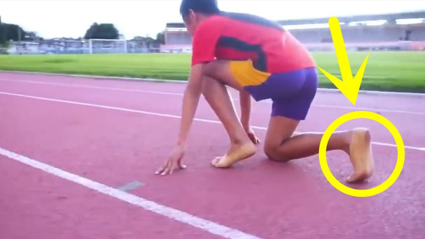 11岁女孩因买不起运动鞋,光脚缠上绷带上场,并赢得了比赛!