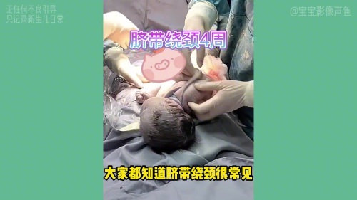 真牛!当医生划开妈妈腹部将宝宝取出,眼前一幕有点太夸张