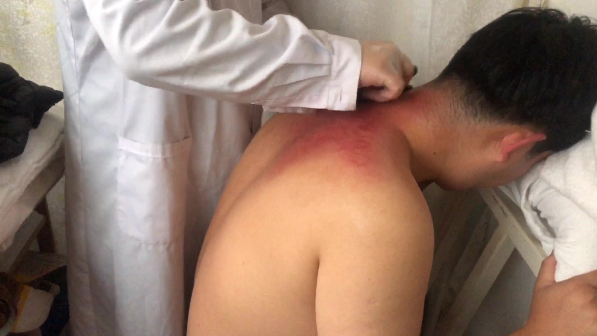 刮痧治疗感冒喉咙痛,就刮三角区,老偏方效果好见效快,不妨试试