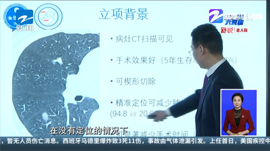 肿瘤手术定位难 浙二医生给肺结节插上“小红旗”
