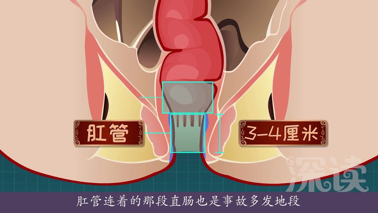 深读小视频-痔疮(04)痔疮到底怎么来的?