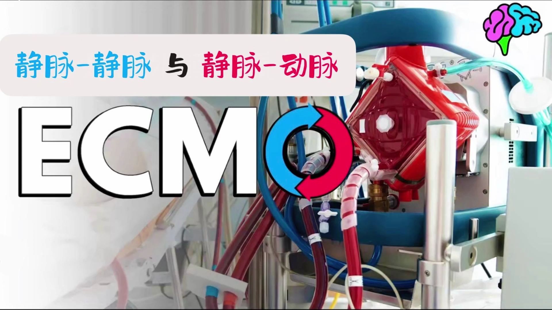 2、静脉-静脉与静脉-动脉体外膜肺氧和(ECMO)【ICU Advantage 中文...
