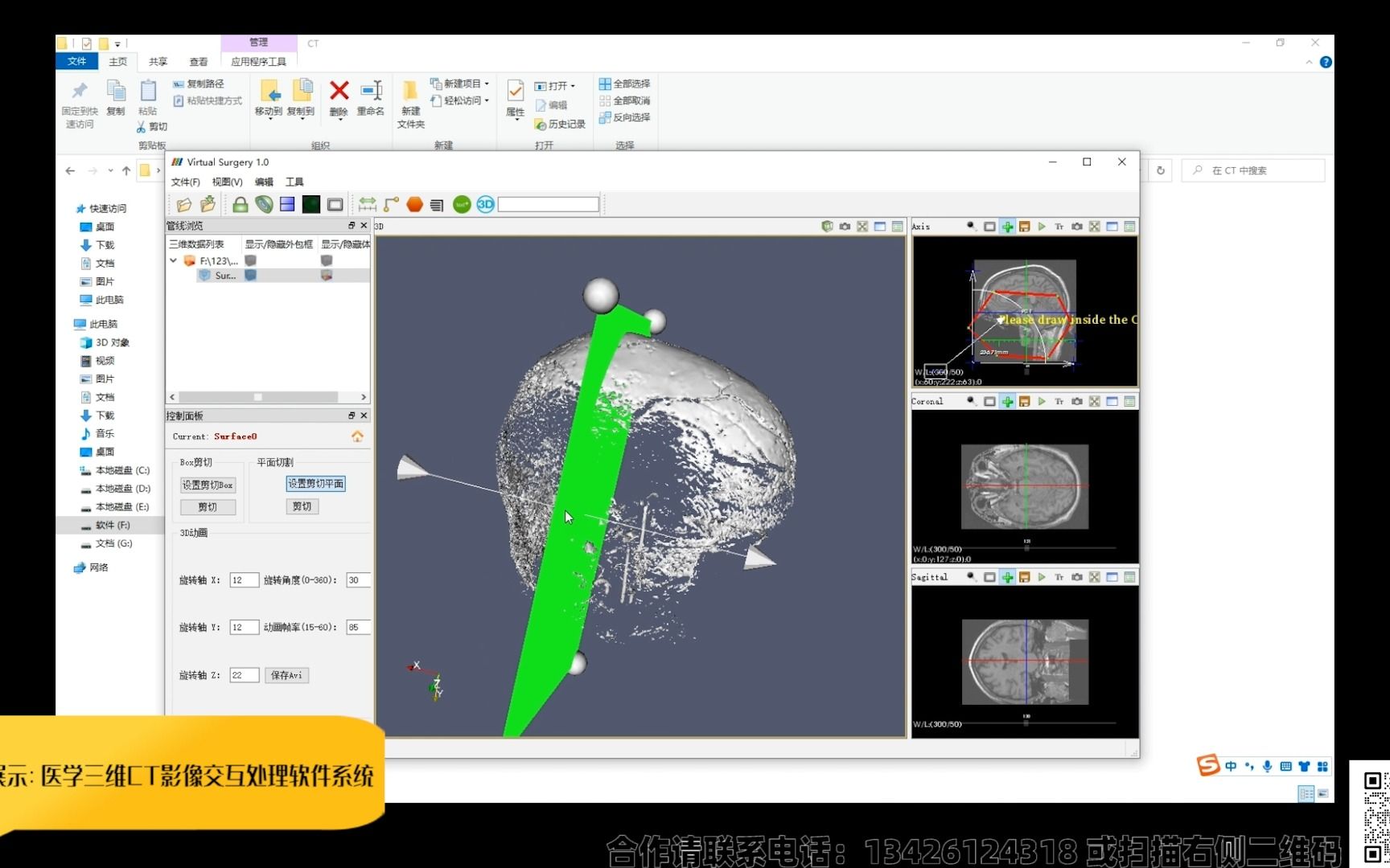 成功产品介绍——医学三维CT影像交互处理软件系统