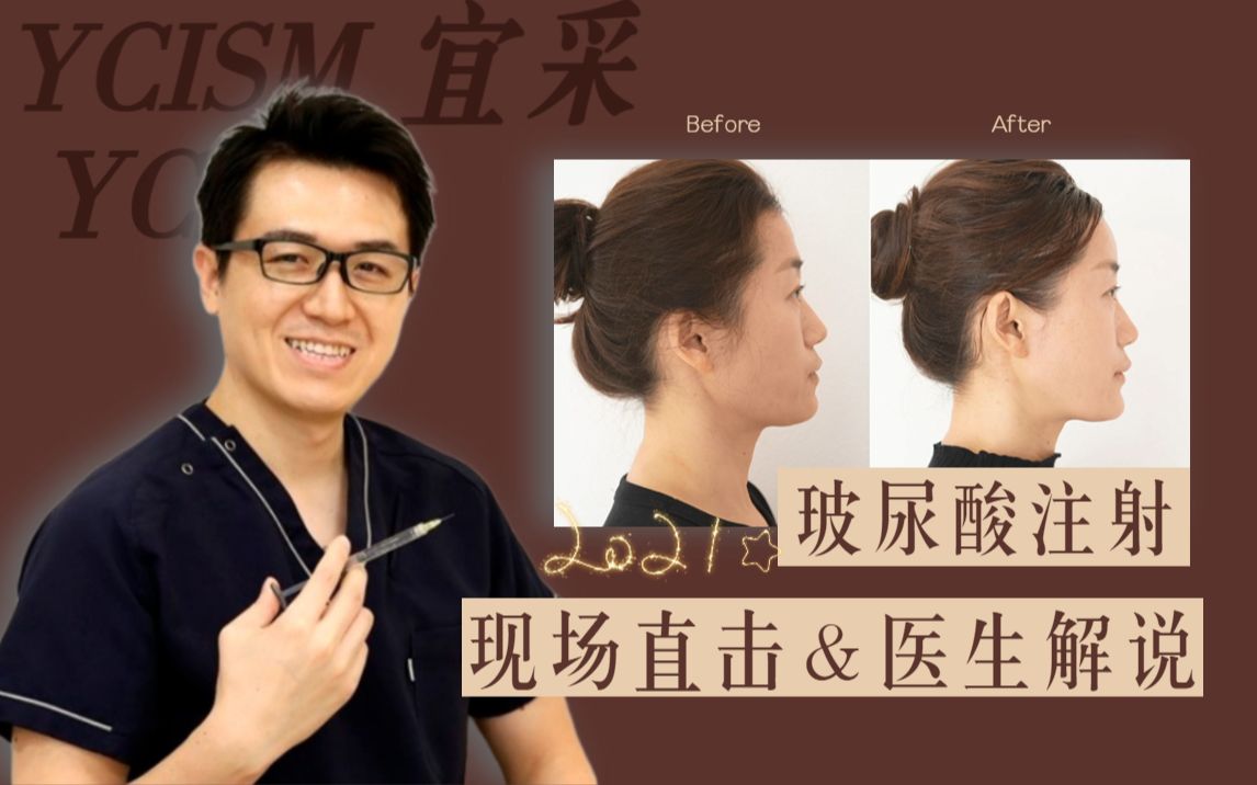 【日本名医】玻尿酸注射现场直击&新井医生解说