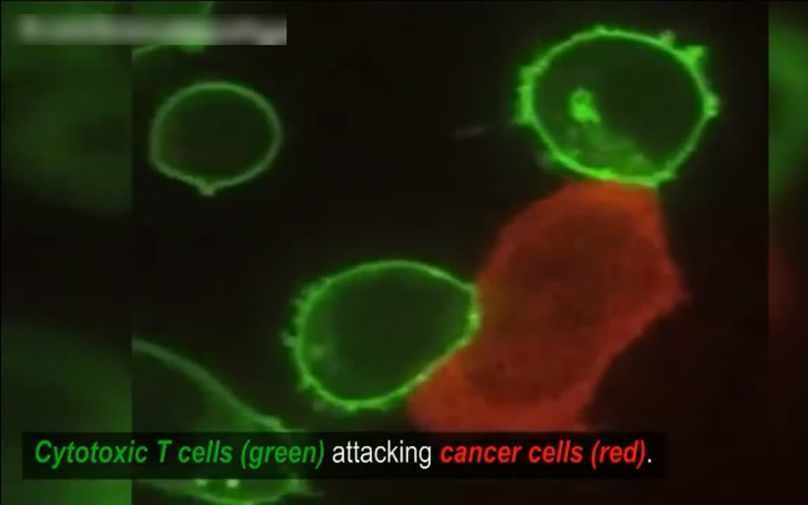 显微镜下看人体细胞杀死癌细胞、细菌、病毒,如同战争大片