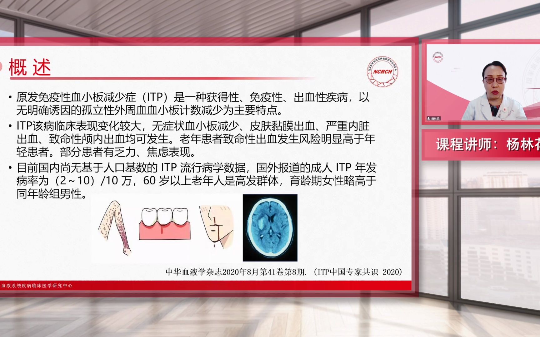 杨林花教授:原发免疫性血小板减少症(ITP)的诊断与治疗
