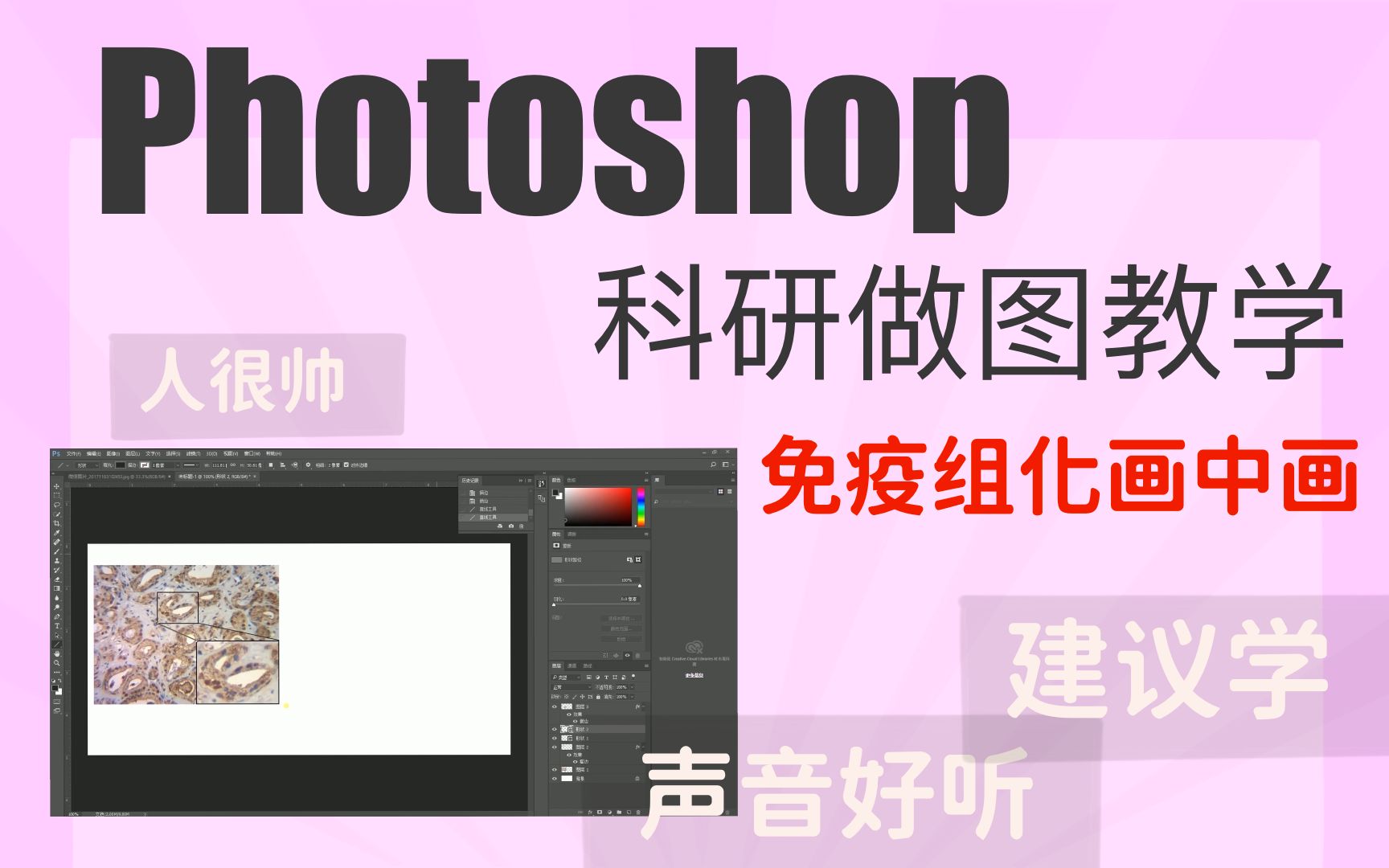 【科研作图】PS科研作图教程|免疫组化画中画的制作|男声好听系列,...