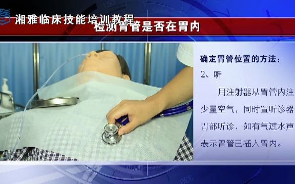 视频2-1-1:插胃管——检测胃管是否在胃内