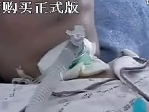气管切开术病人护理