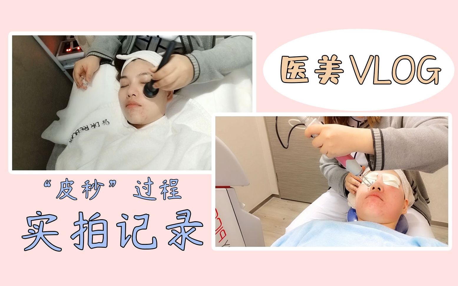 亲历皮秒激光【我去做皮秒了!】皮秒激光全过程与亲身感受 我的皮肤...