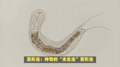 变形虫:特殊的细胞器,称为伪足,它们进行运动和摄食的主要工具