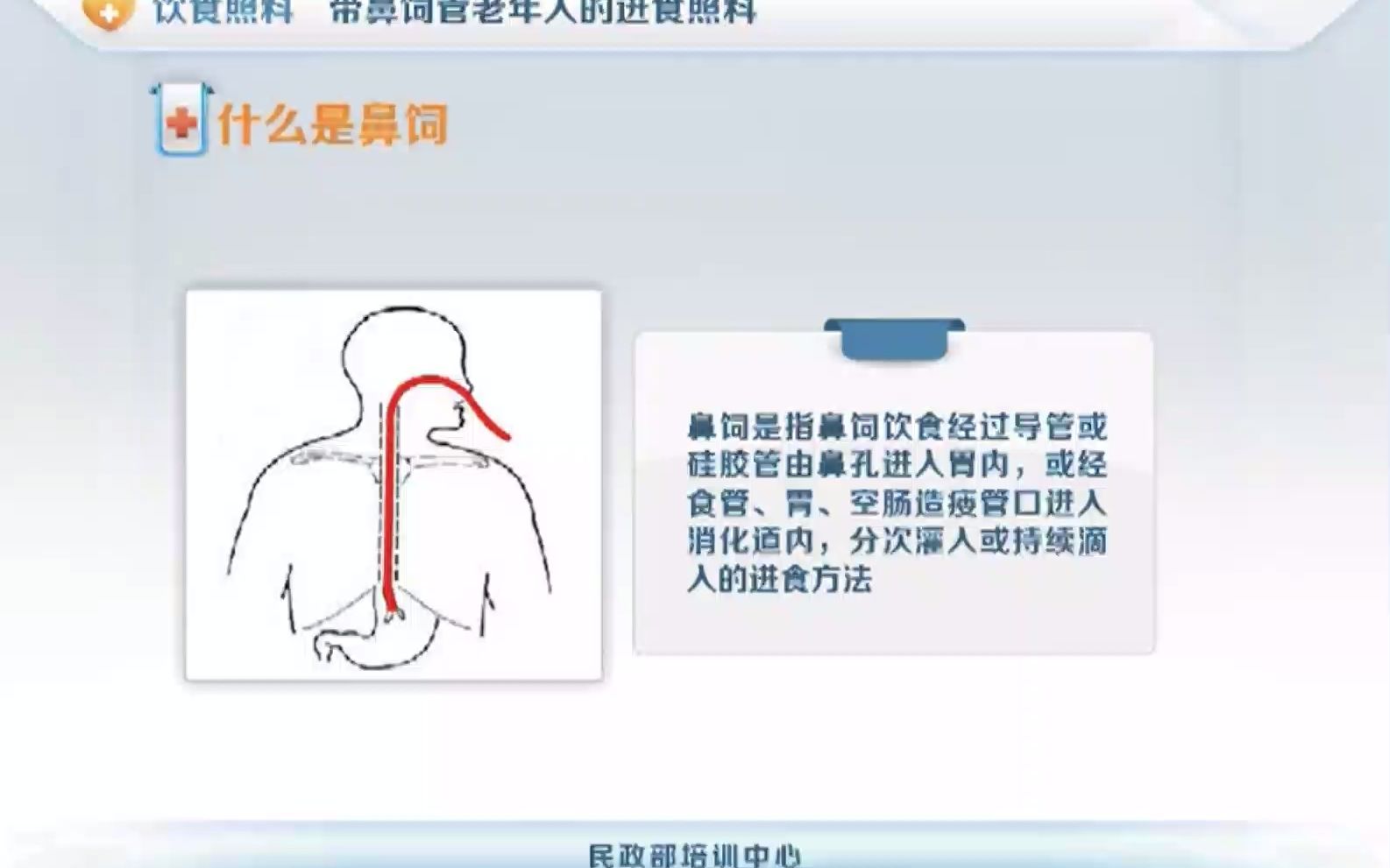 带鼻饲管老年人的进食照料