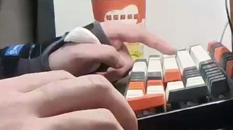 手断了 表演一下一根手指玩kz_网络游戏热门视频