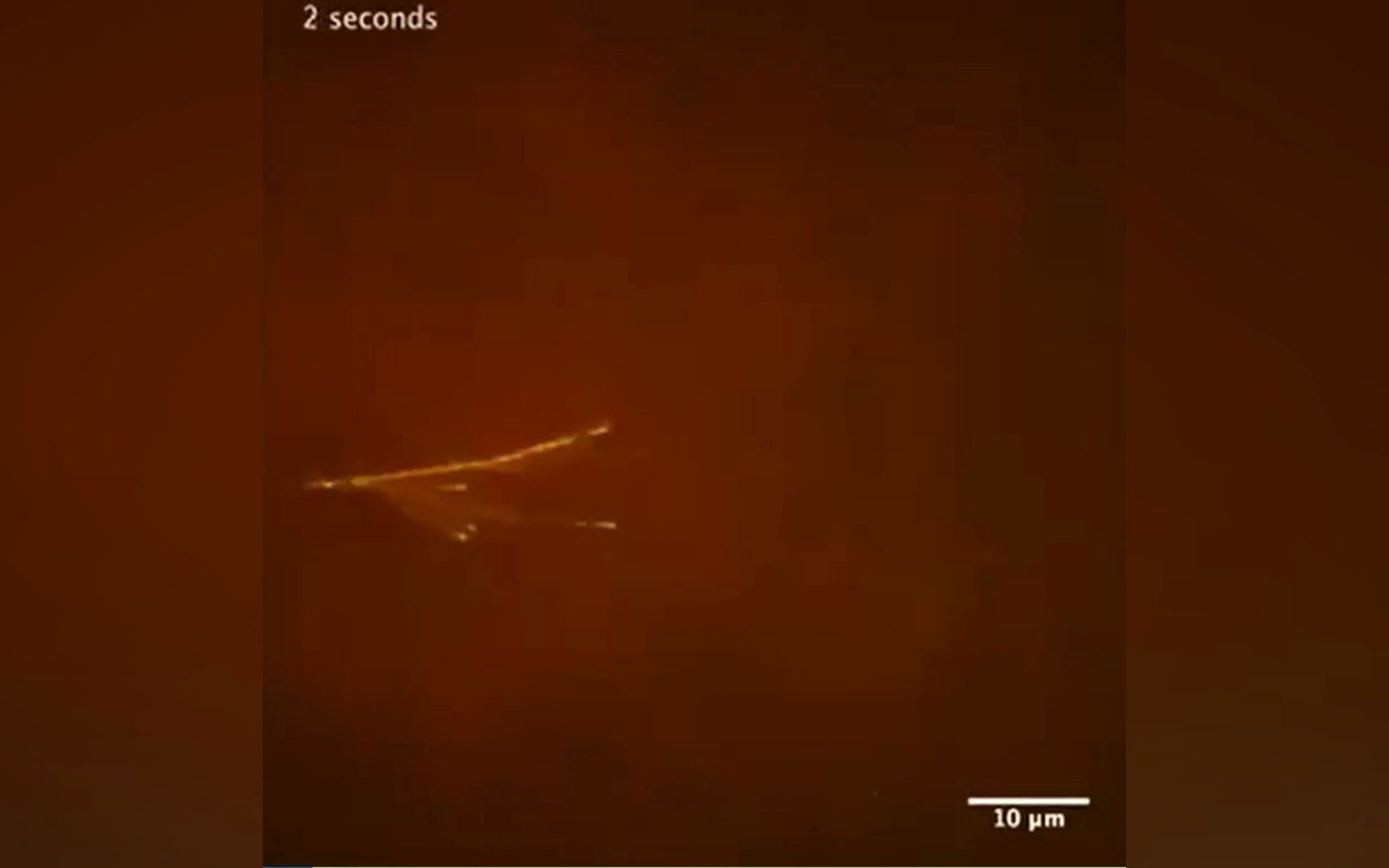 微管生长形成有丝分裂纺锤体现场