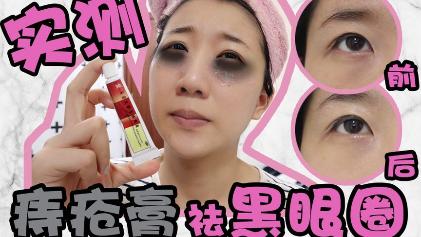 「实测」痔疮膏祛黑眼圈!活血化瘀 去腐生肌~你看看可有效果?!