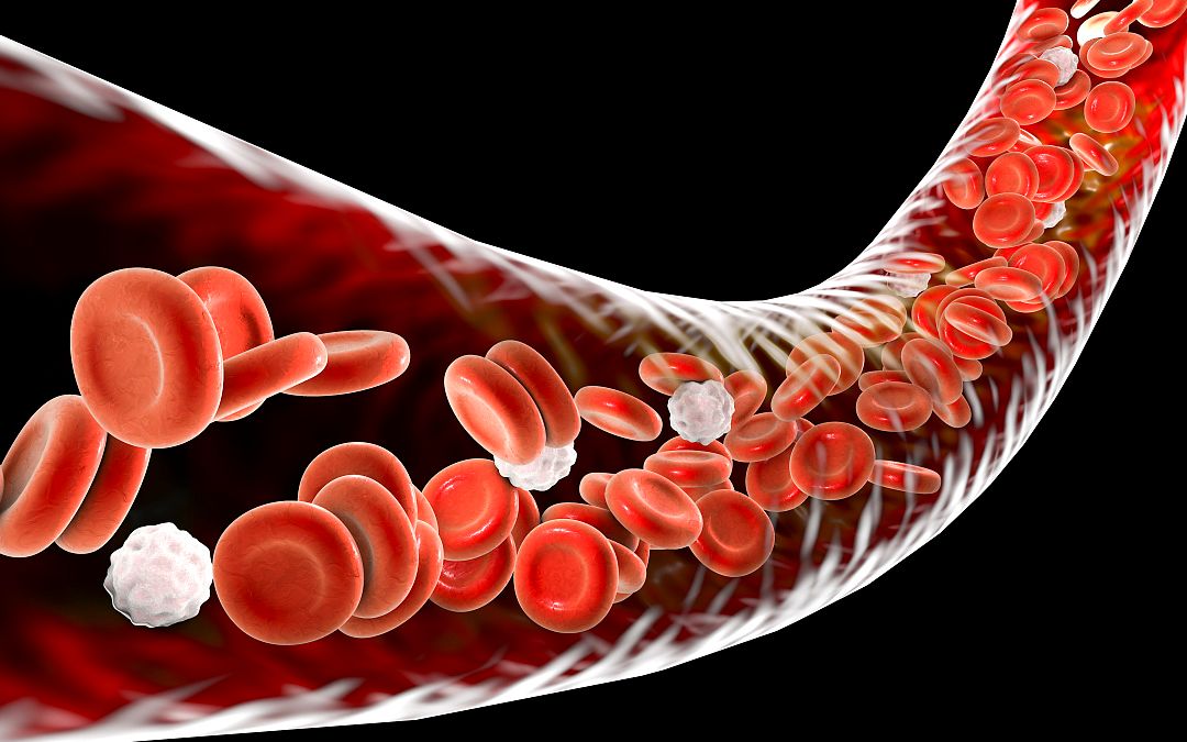 不可小觑的颈动脉斑块,原来可以这样预防,医生为你讲解!mp4