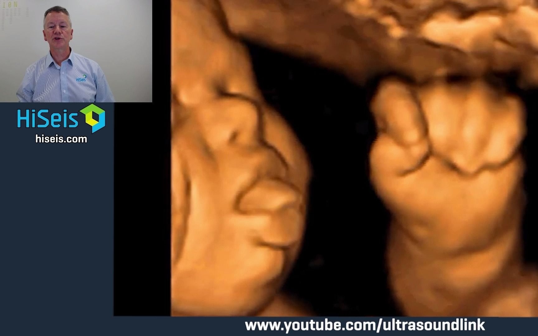 ...Tropicana_KevinJarvis—GeoSoftware地质统计学反演技术挖金矿