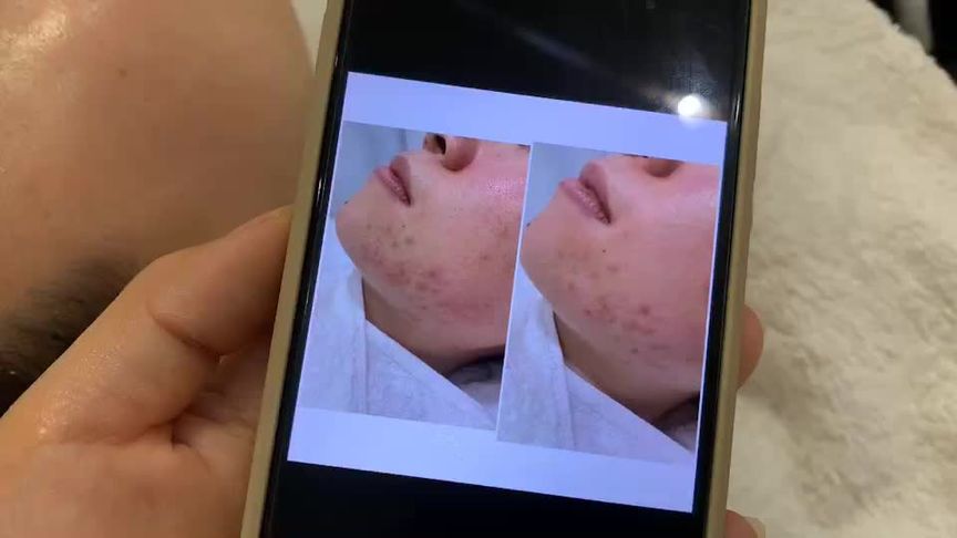 任丘龙泉路简际量肤管理中心!专业细胞修复调理问题性肌肤!