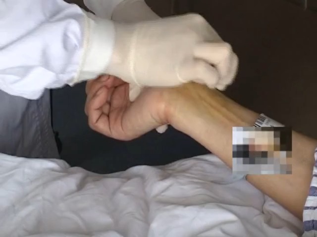 动脉穿刺术