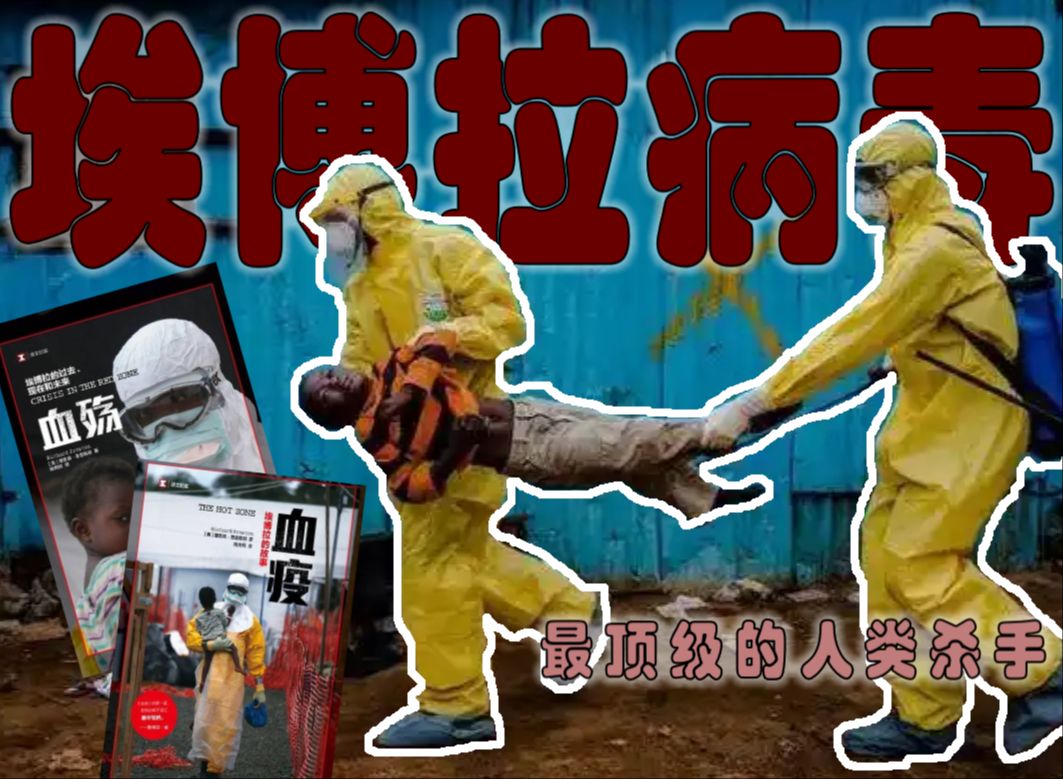 致死率高达88%,艾滋病病毒跟它相比只是个幼稚园小朋友