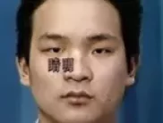 人-体穴位与推拿