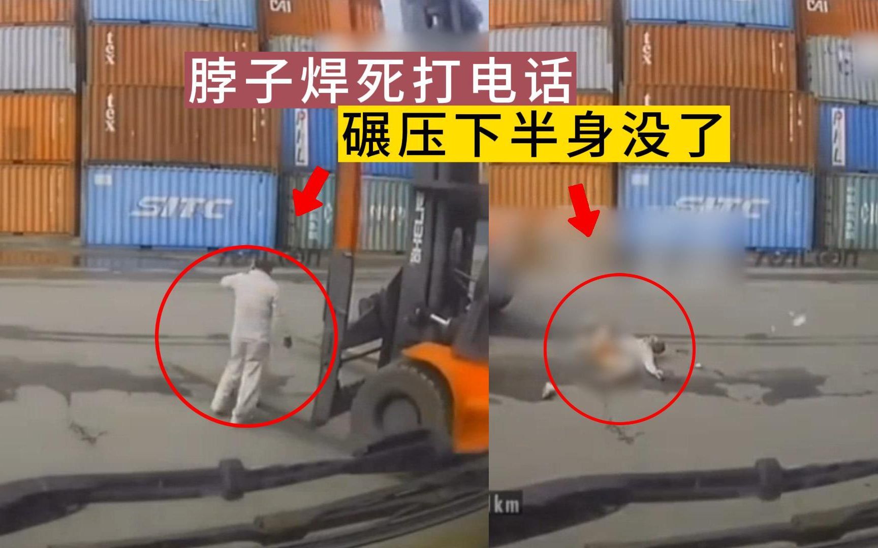 惨遭叉车碾压下半身没了,眼睁睁看着自己走向身亡