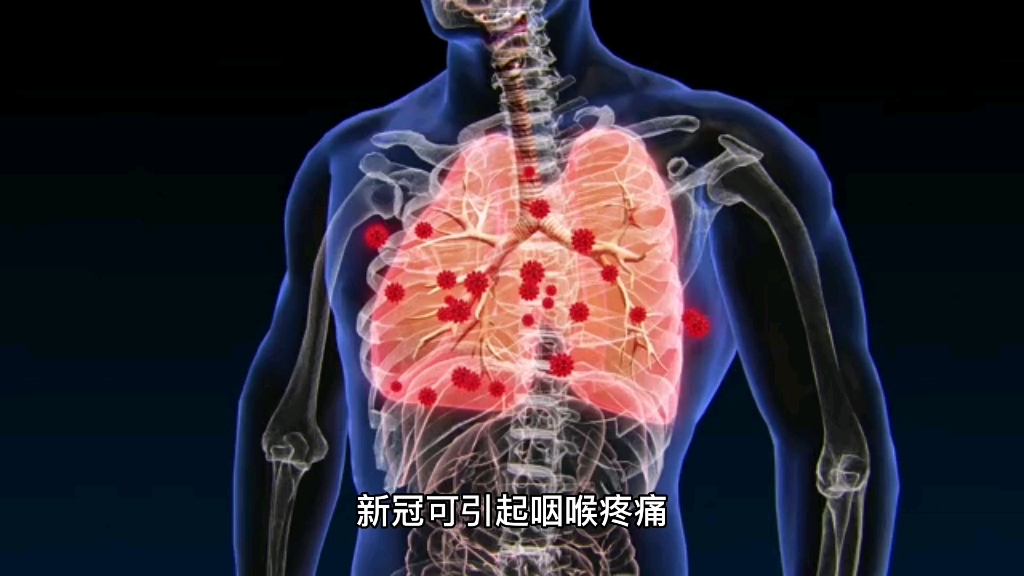 新冠后如何缓解咽喉疼痛