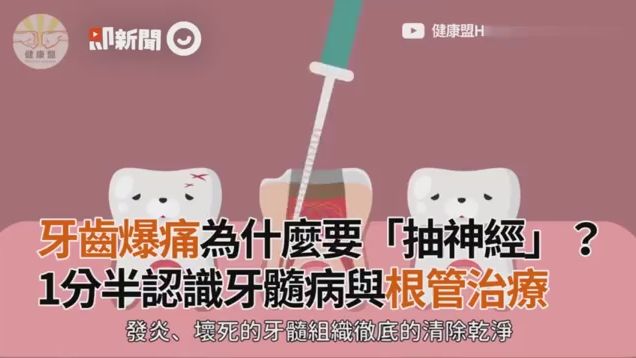 牙齿痛为什么要抽“神经”ߘ�,带你了解牙髓病和根管治疗ߤ