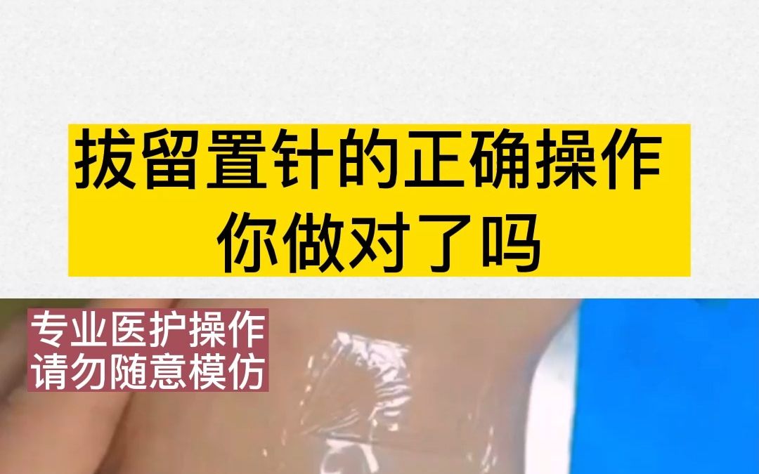 拔留置针的正确操作,你做对了吗?