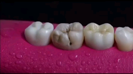 一起看看,真实的根管治疗全过程!